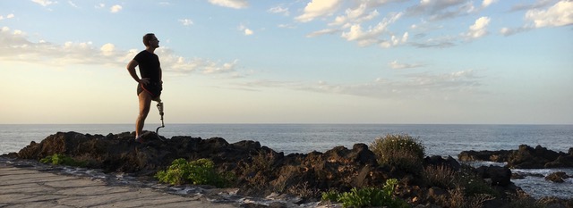 Karl’s Story – VGK Very Good Knee